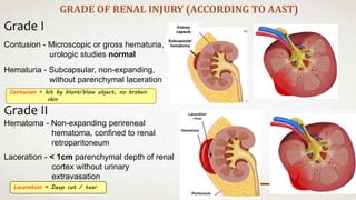 Renal trauma for students nurses | PPTX