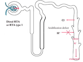 Renal tubular acidosis | PPT