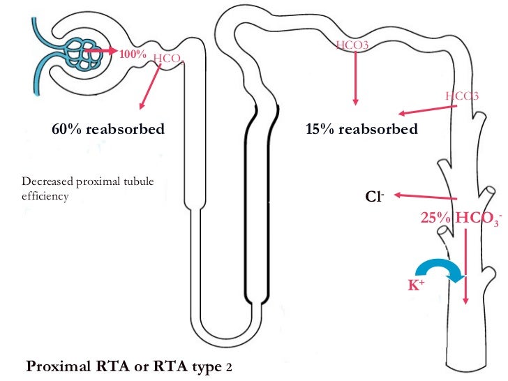 Renal tubular acidosis