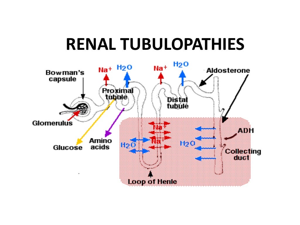 Renal tubular acidosis