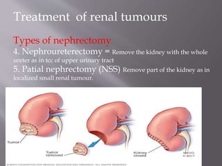 Renal tumor | PPTX