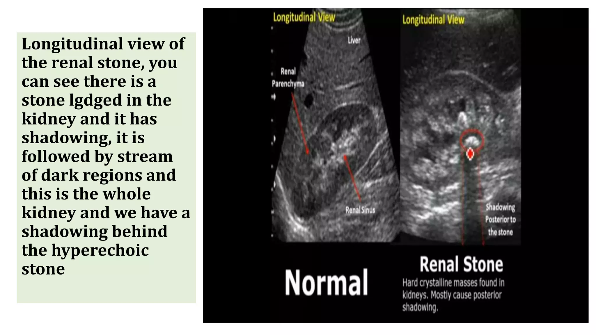 renal ultrasound.pptx
