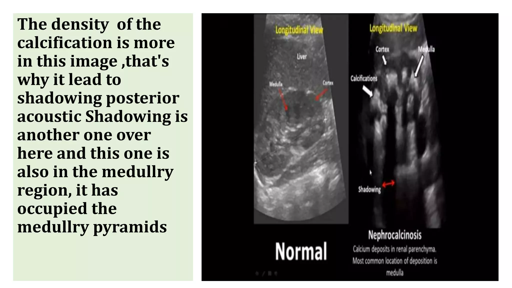 renal ultrasound.pptx