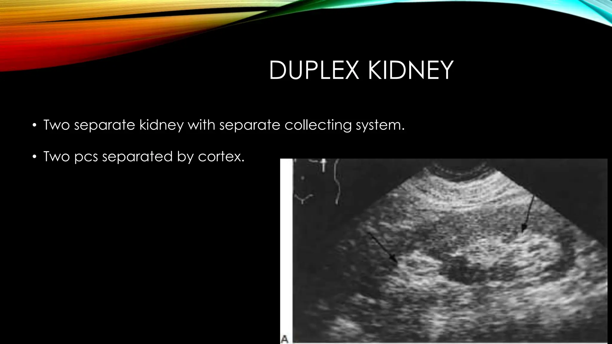 Renal pathology in Ultrasound.pdf