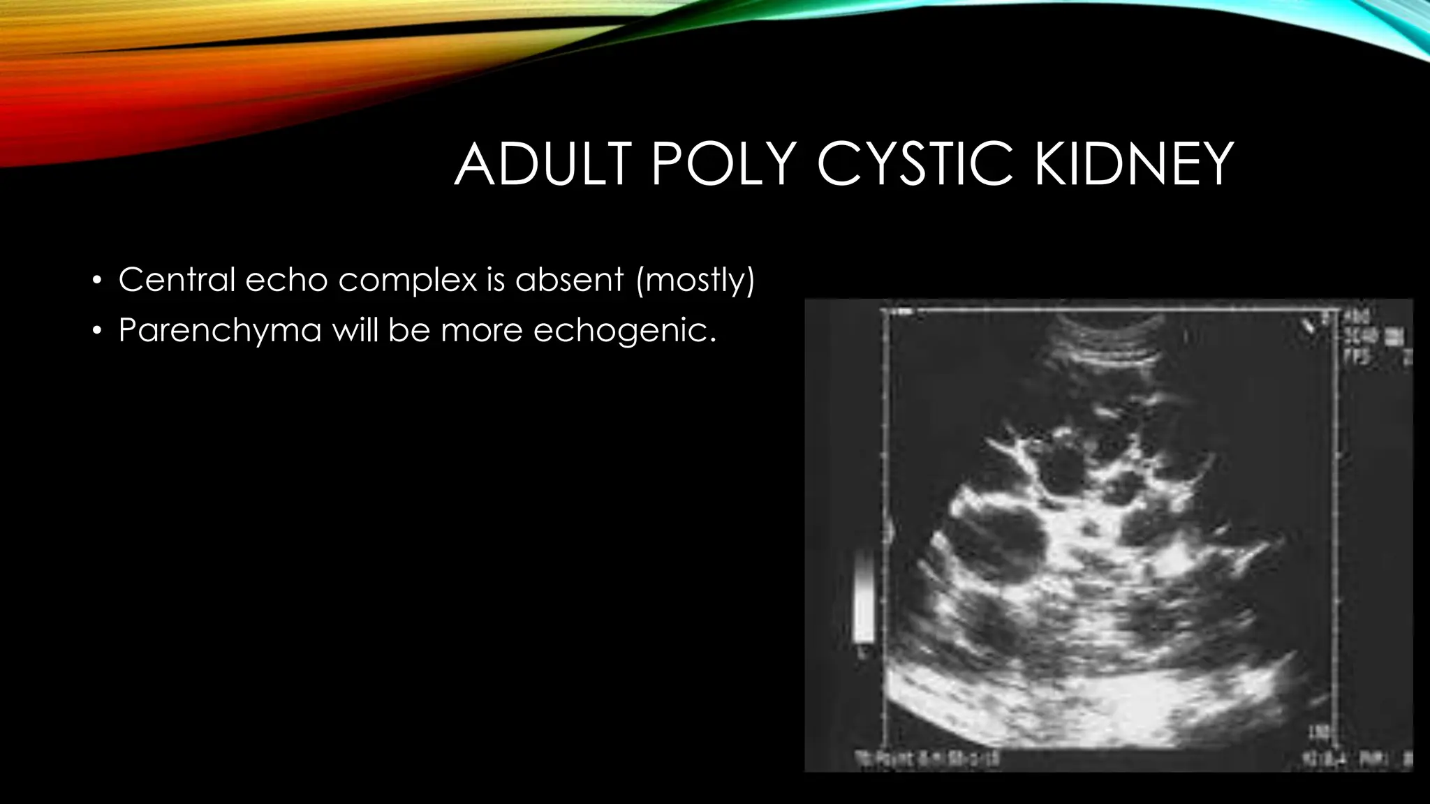 Renal pathology in Ultrasound.pdf