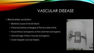 Renal pathology in Ultrasound.pdf