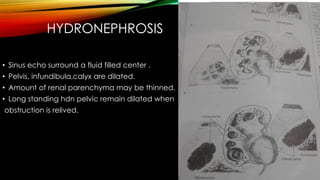 Renal pathology in Ultrasound.pdf