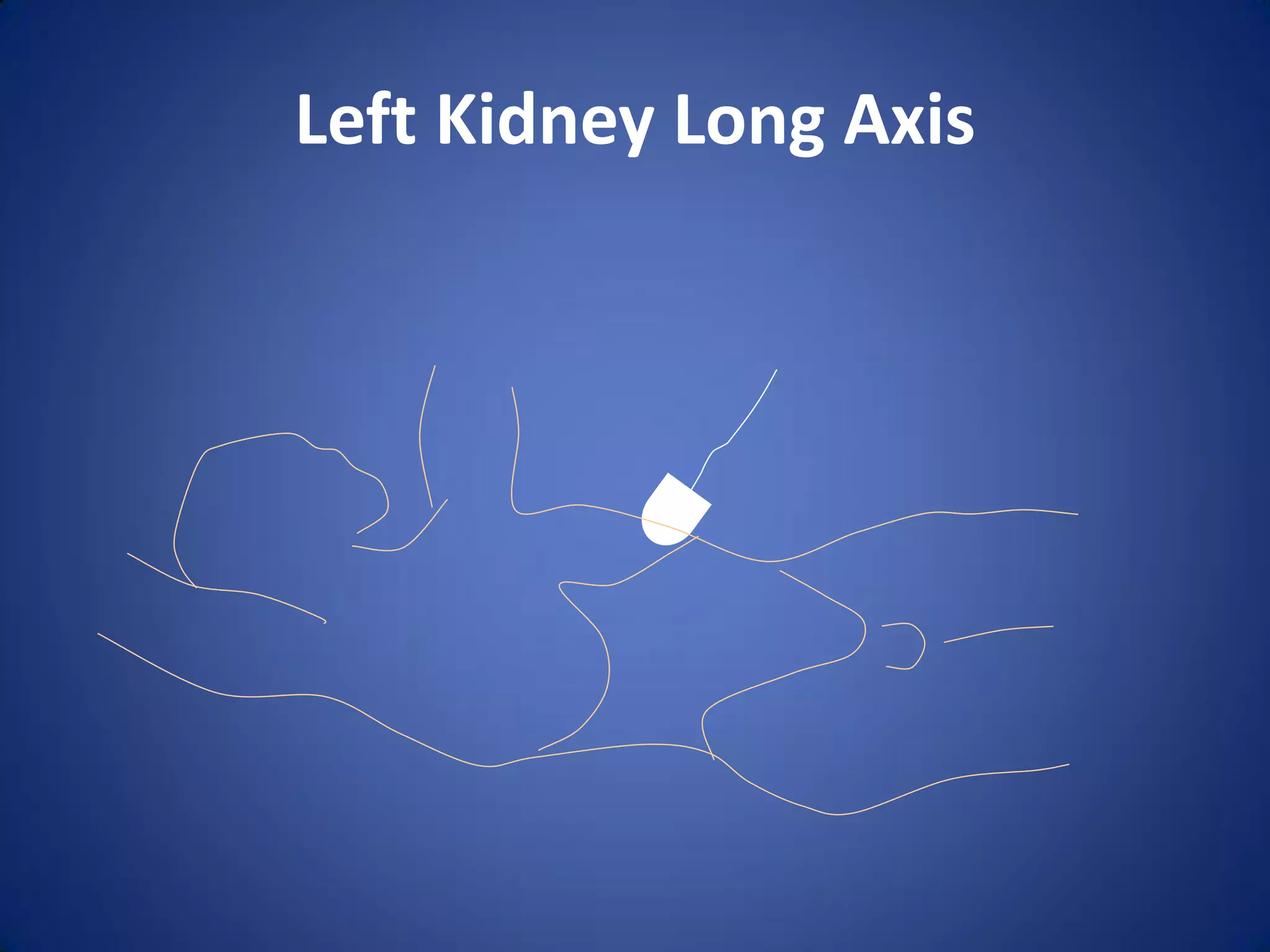Renal us 2017 | PDF