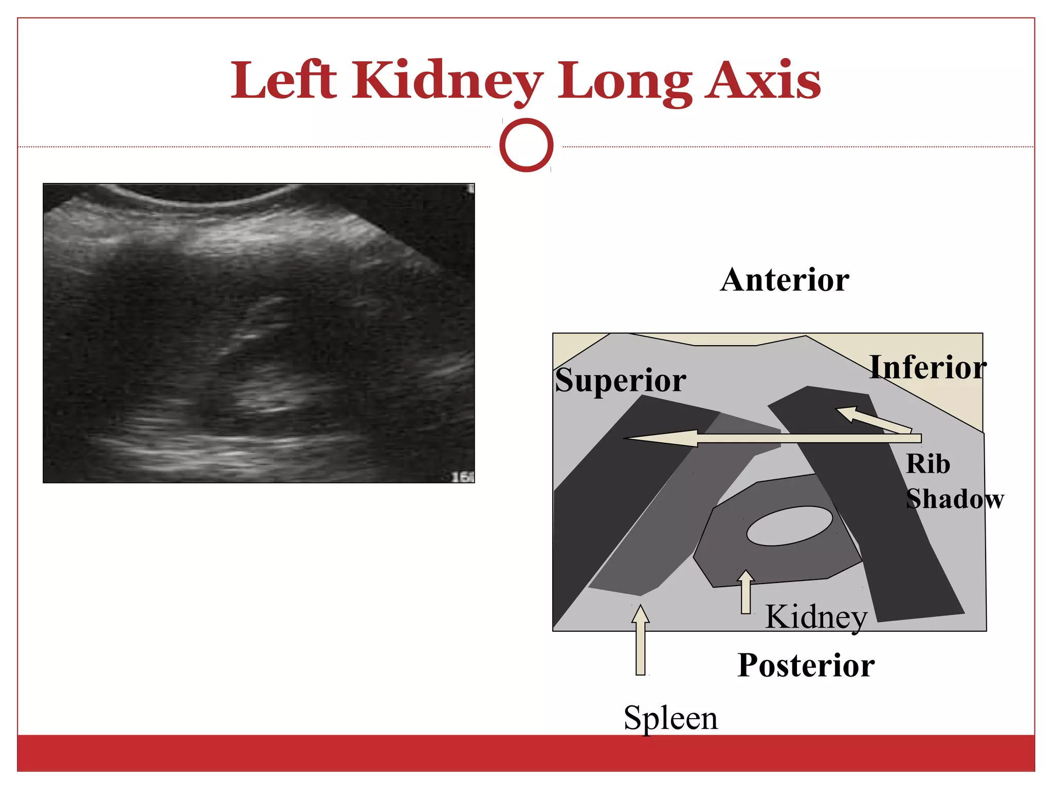 Renal us dr.doaa sharaf md | PPT