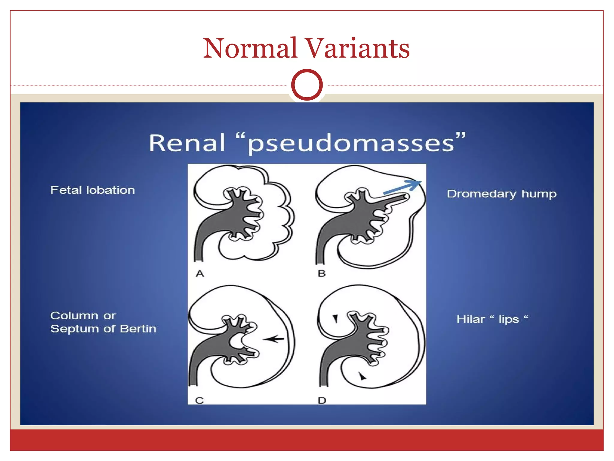 Renal us dr.doaa sharaf md | PPT