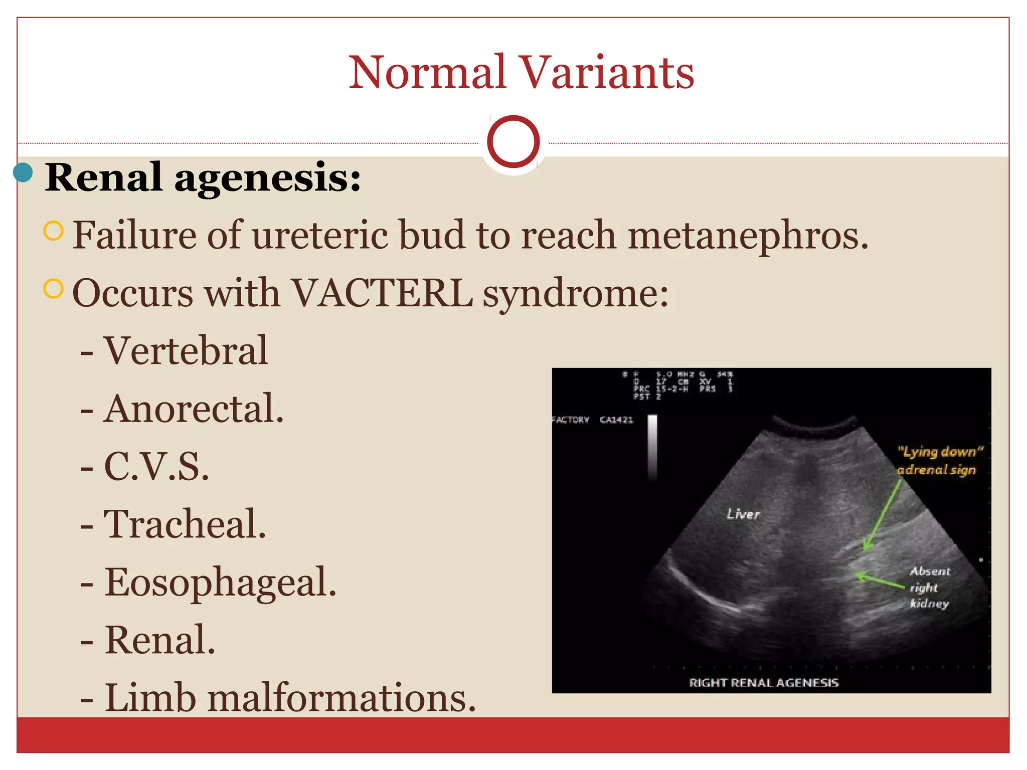 Renal us dr.doaa sharaf md | PPT