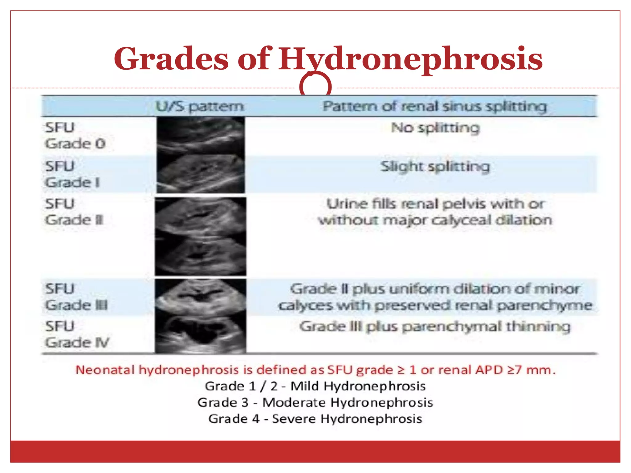 Renal us dr.doaa sharaf md | PPT