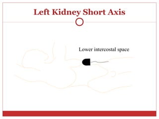 Renal us dr.doaa sharaf md | PPT