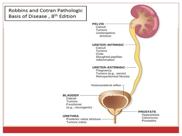 Renal us dr.doaa sharaf md | PPT