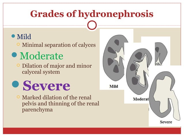 Renal us dr.doaa sharaf md | PPT