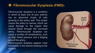 Renal vascular disease | PPSX