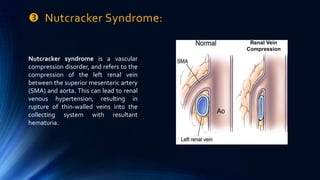 Renal vascular disease | PPSX