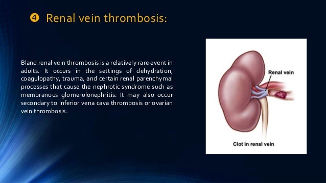 Renal vascular disease
