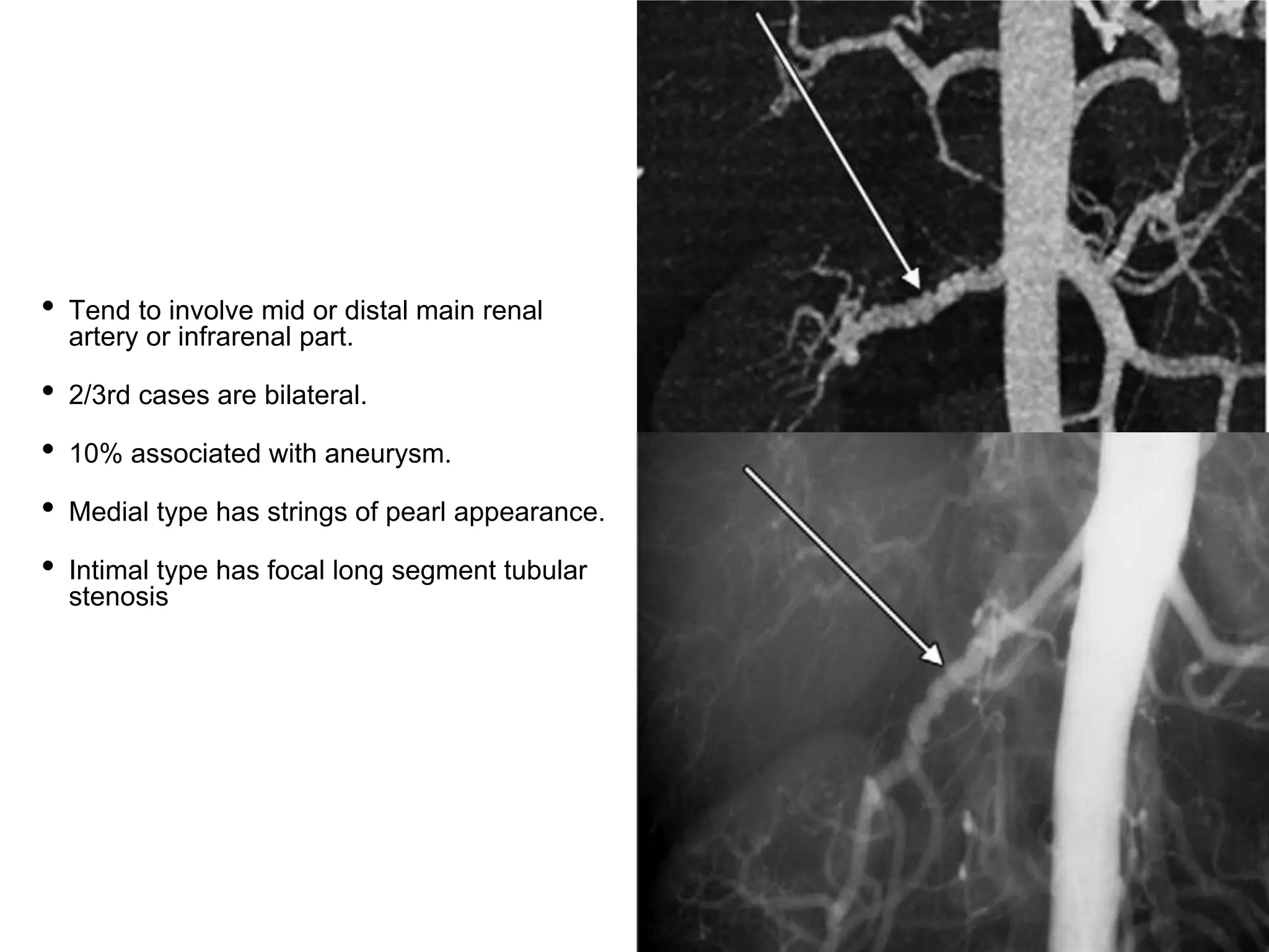 A practical guide to Renal Vascular Diseases.pptx