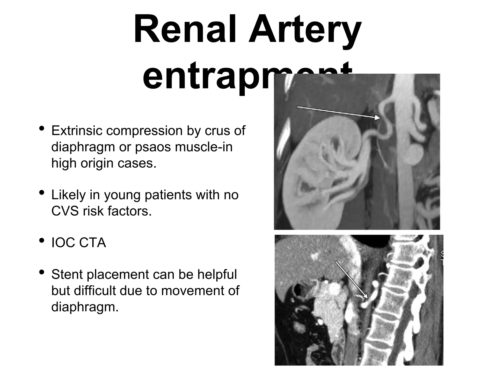 A practical guide to Renal Vascular Diseases.pptx