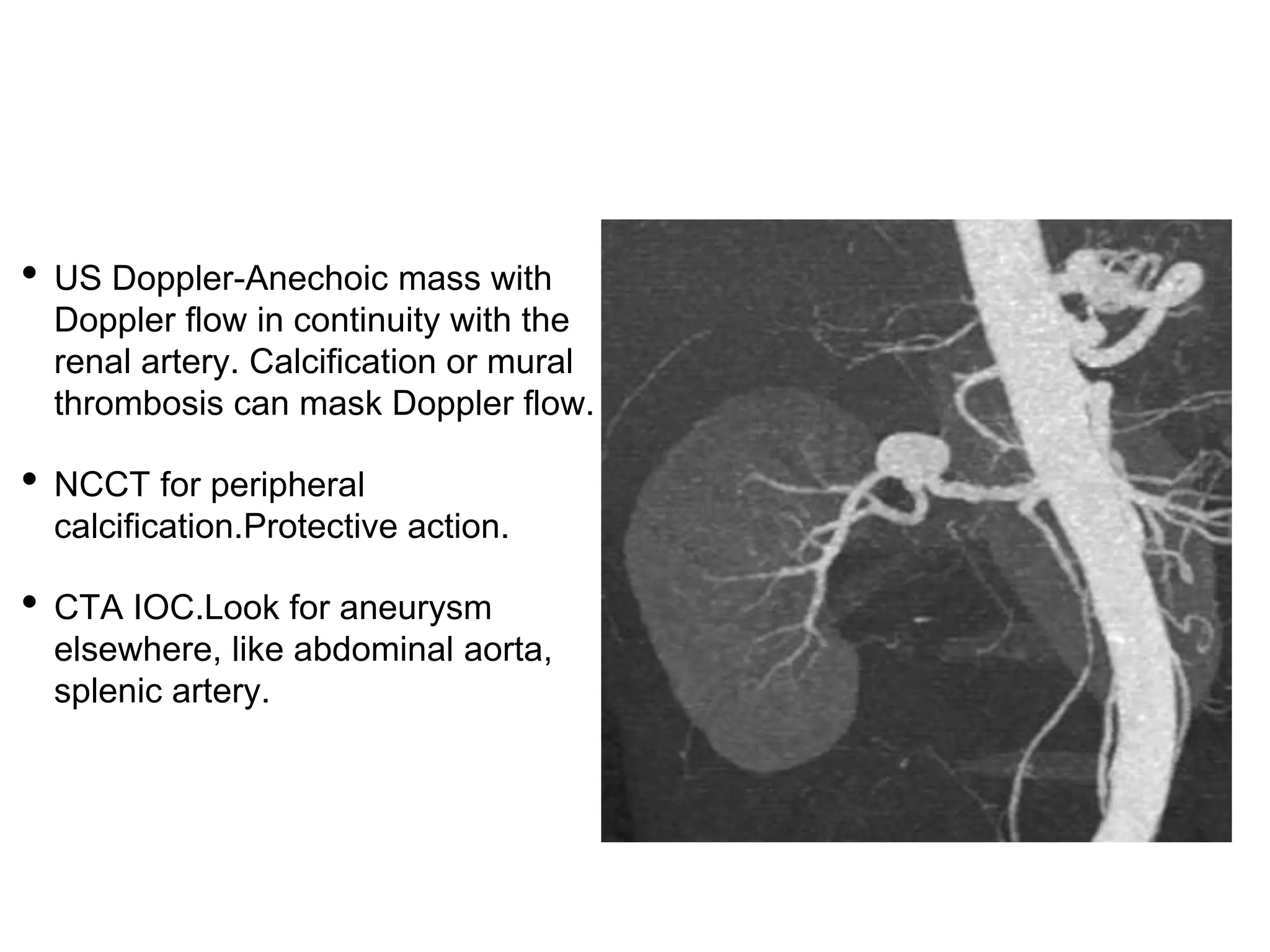 A practical guide to Renal Vascular Diseases.pptx