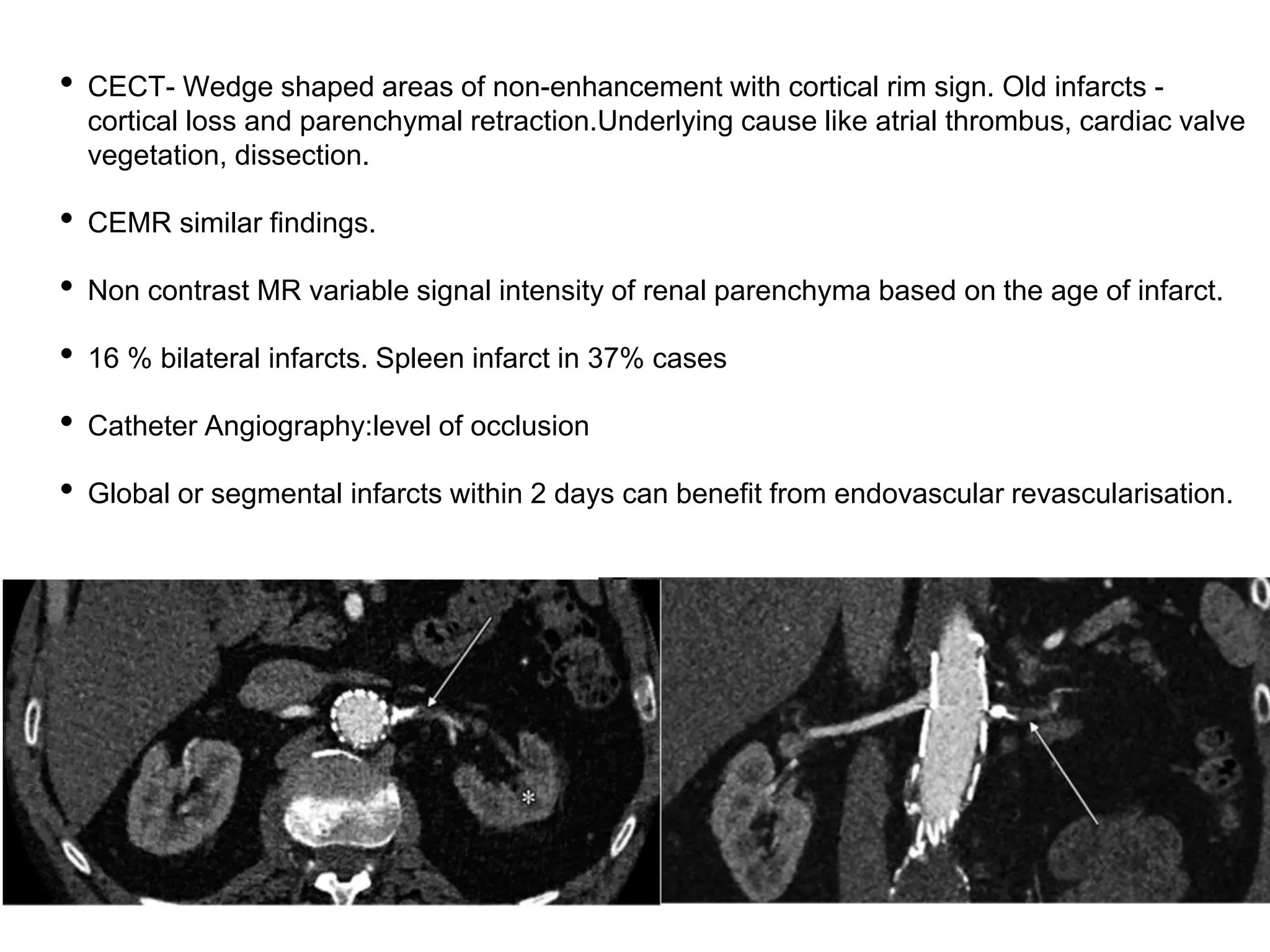 A practical guide to Renal Vascular Diseases.pptx