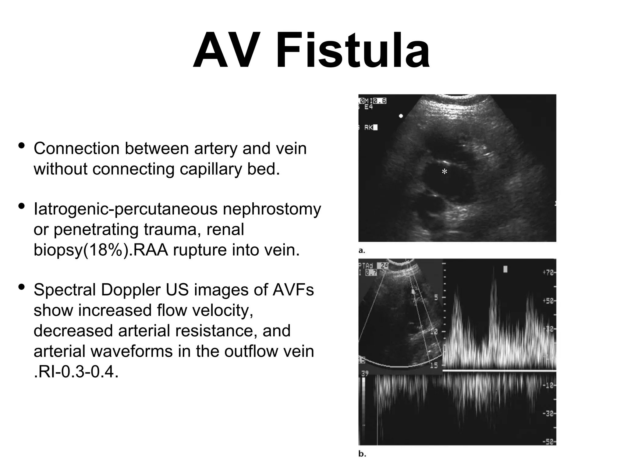 A practical guide to Renal Vascular Diseases.pptx
