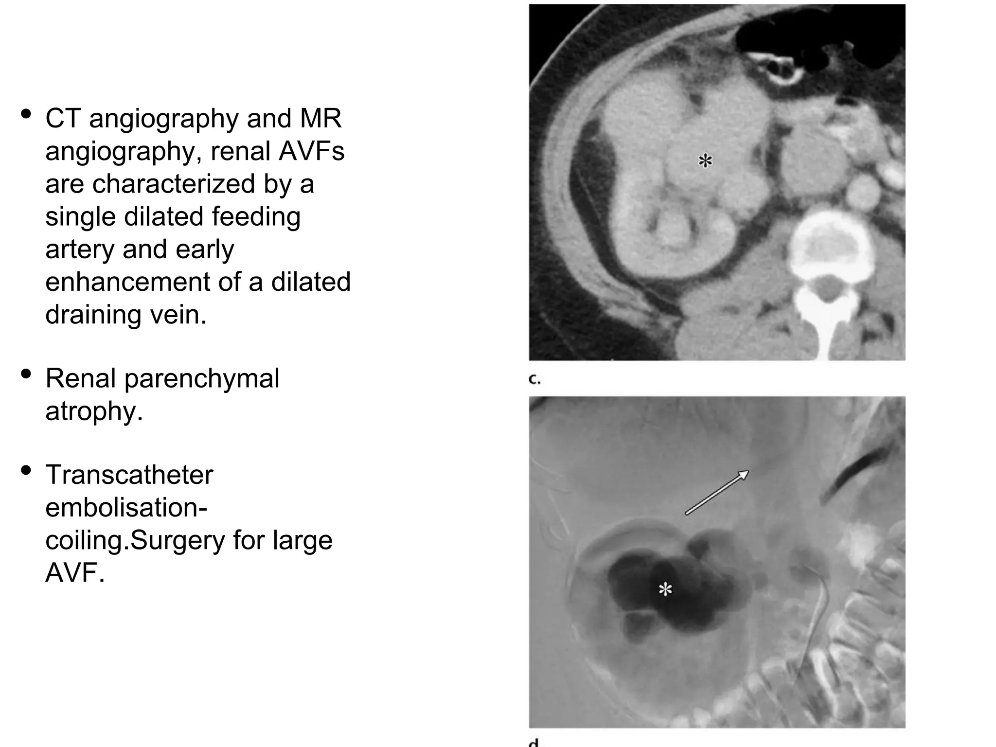 A practical guide to Renal Vascular Diseases.pptx