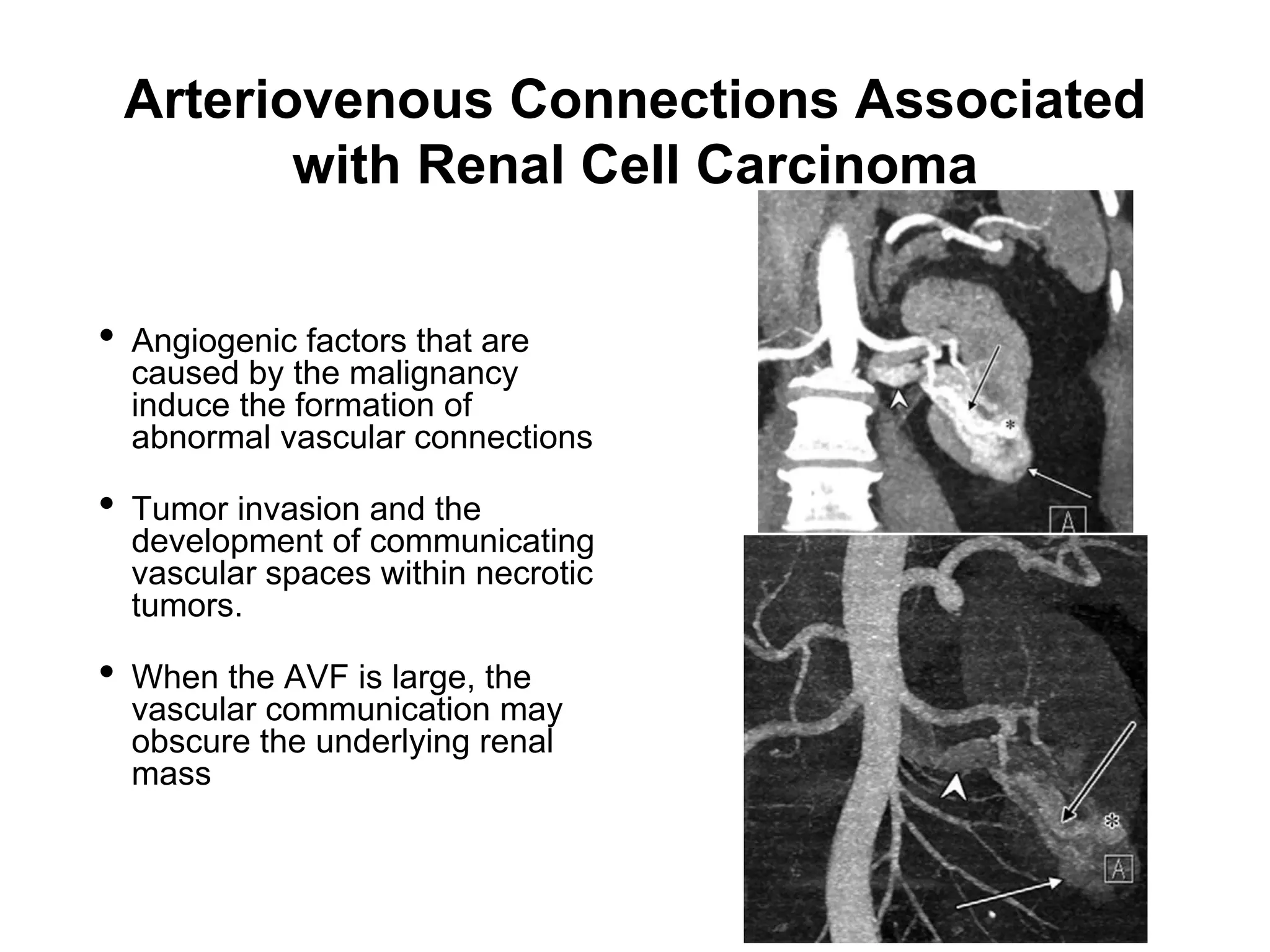 A practical guide to Renal Vascular Diseases.pptx