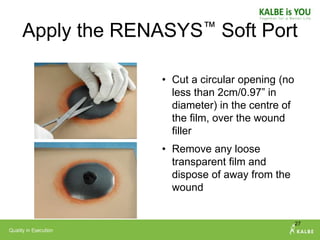 RENASYS.ppt