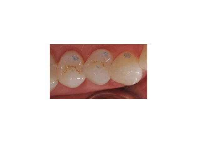 Rencana perawatan pendukung GTSL | PPTX