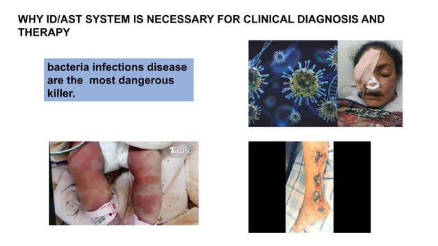 Render MA120 microbiology AST/ID system.pptx | Infectious Diseases ...