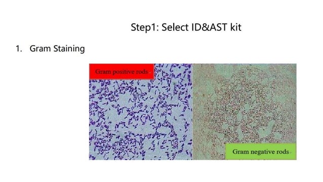 Render MA120 microbiology AST/ID system.pptx | Infectious Diseases ...