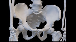 Slide Xray(Pelvis) for Radiation Therapy Programme | PPTX