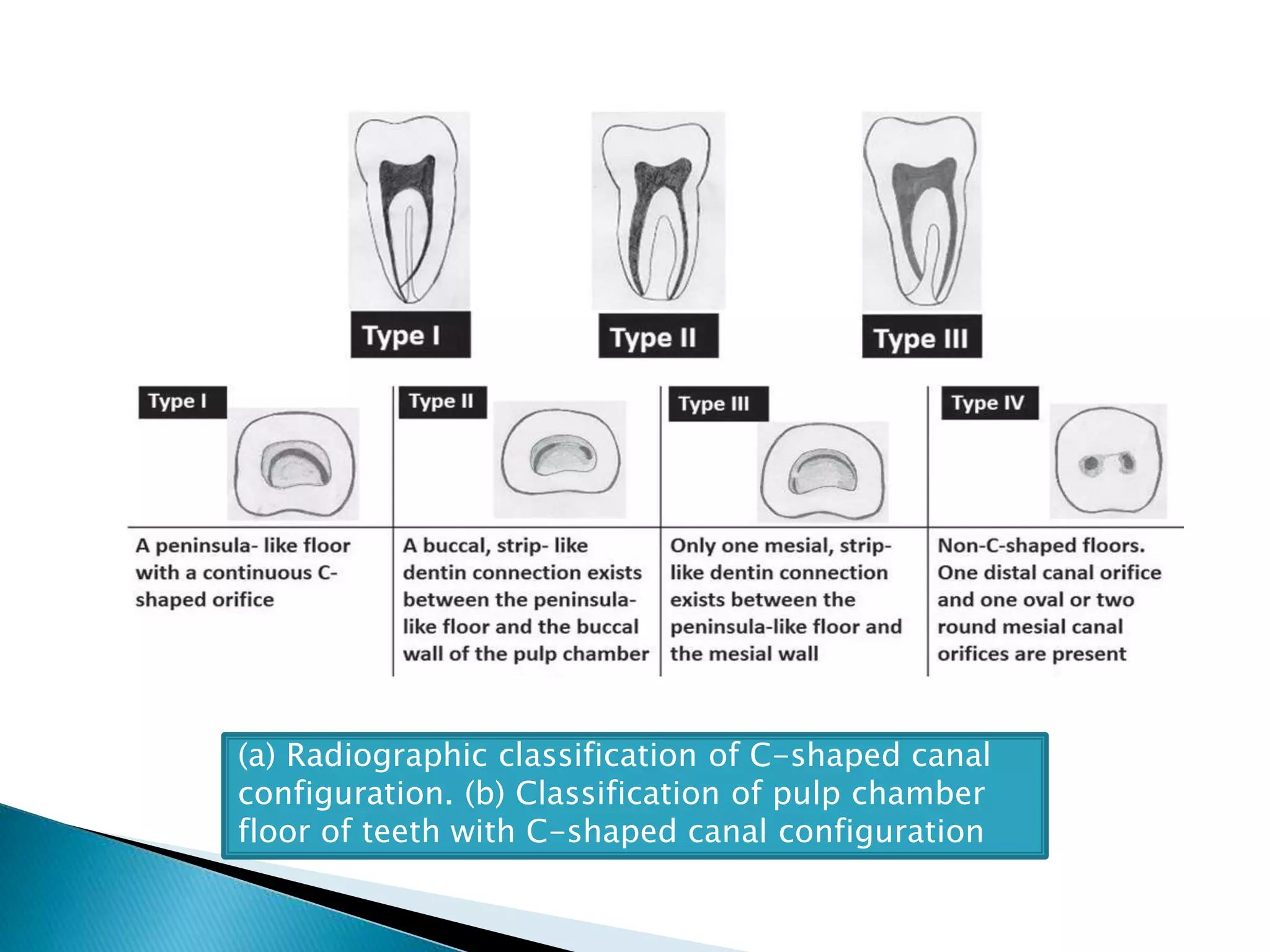 Renjith c shaped canal configuration | PPTX