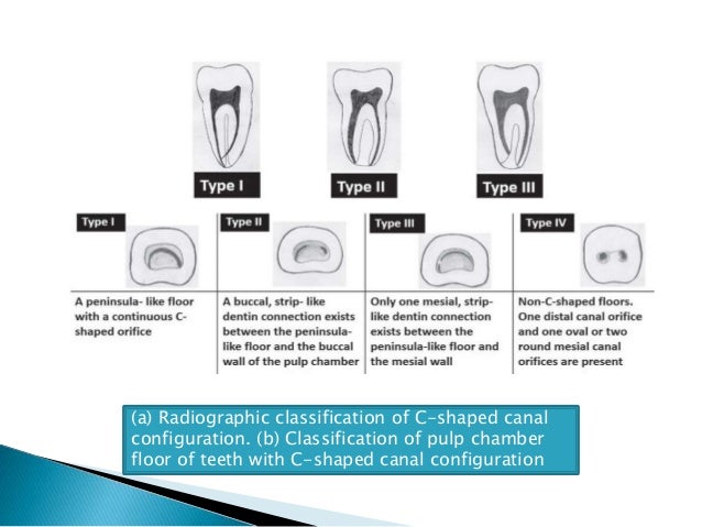 Renjith c shaped canal configuration