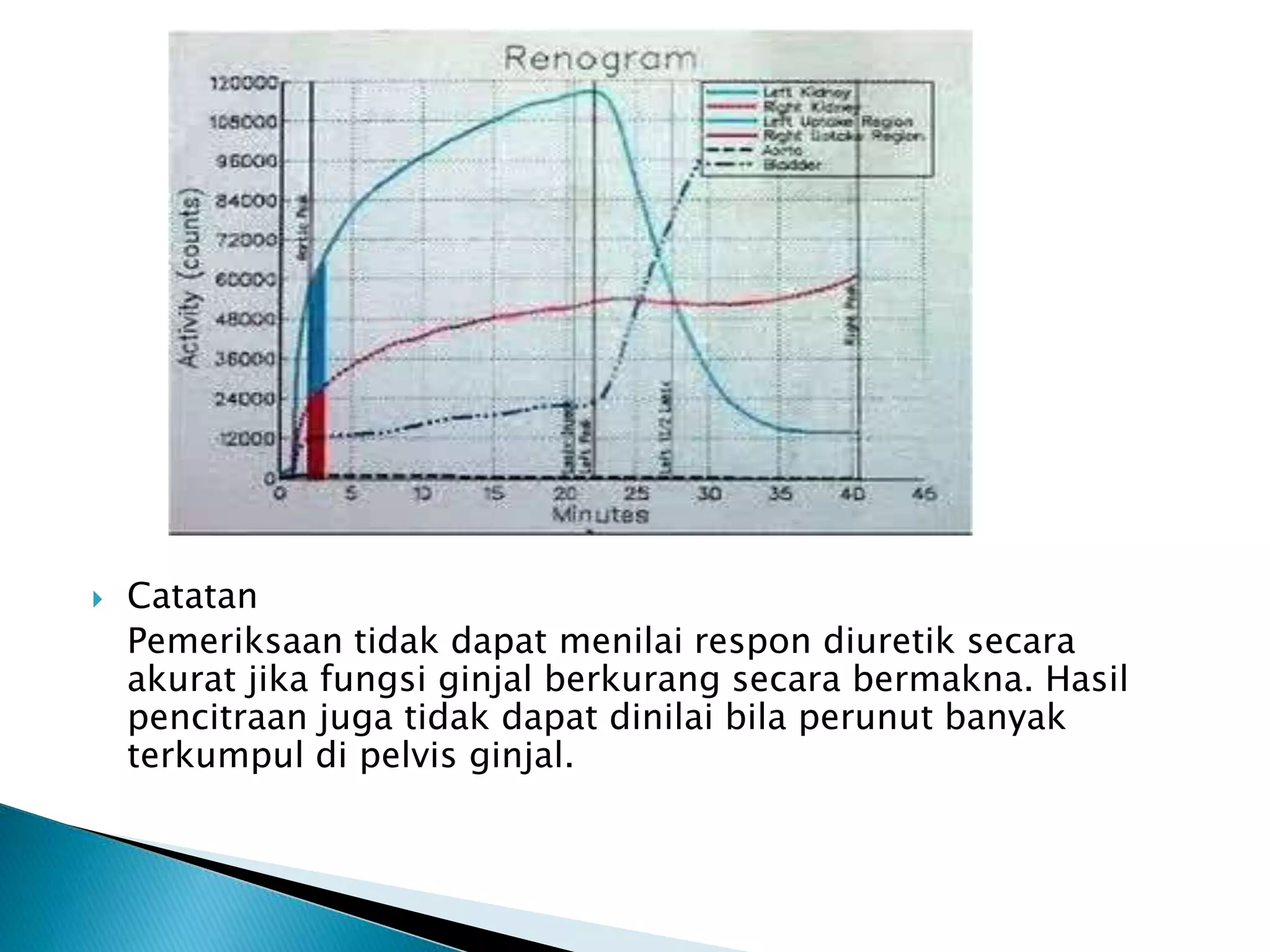 ppt teknik scanning Renogram | PPTX