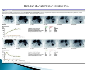 ppt teknik scanning Renogram | PPTX