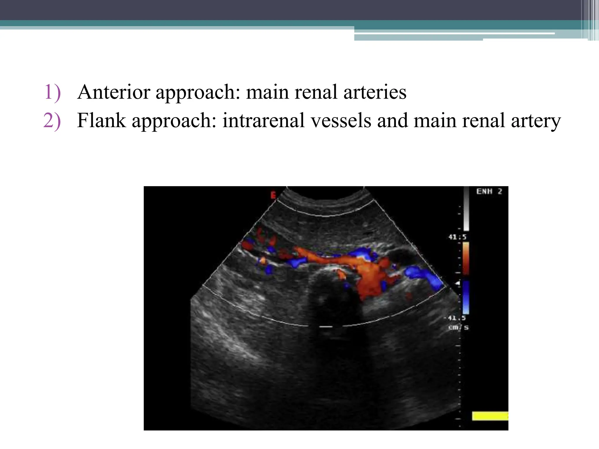 RenoVascular Hypertension in clinical.pptx