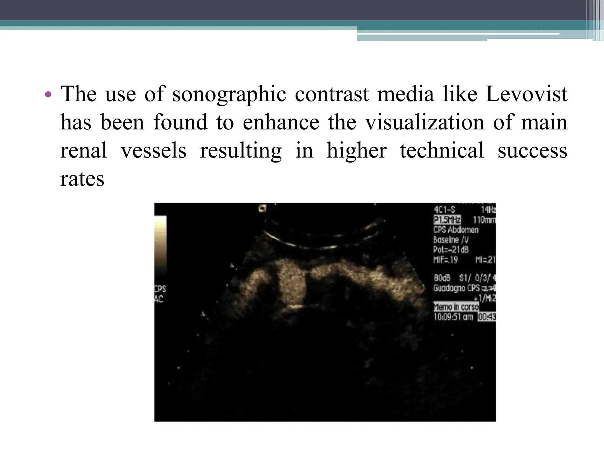 RenoVascular Hypertension in clinical.pptx