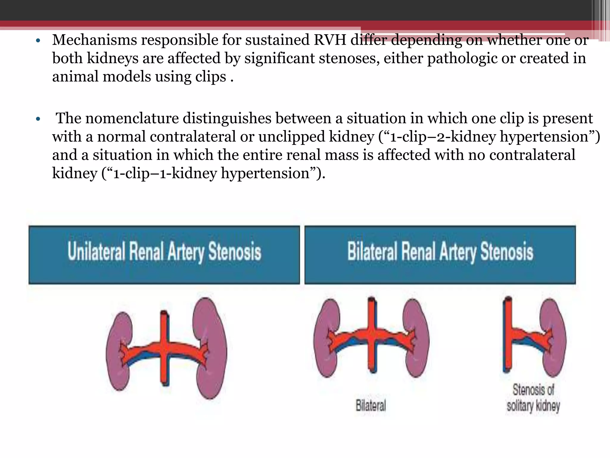 Renovascular hypertension(rvh) | PPTX