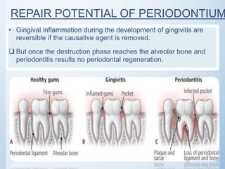 Repair and regeneration of oral tissue | PPTX