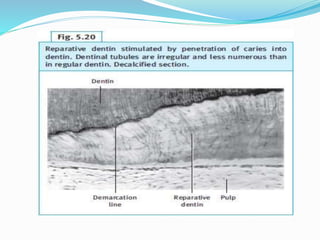 Repair and regeneration of tooth | PPTX