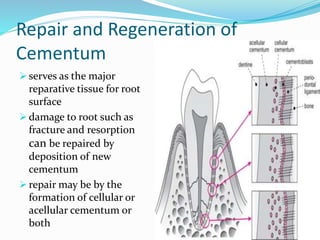 Repair and regeneration of tooth | PPTX