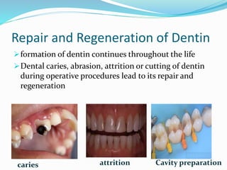 Repair and regeneration of tooth | PPTX
