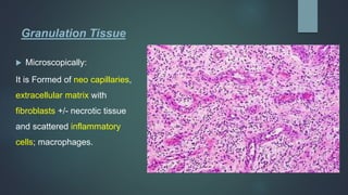 repair for recording (tissue repair) .pptx