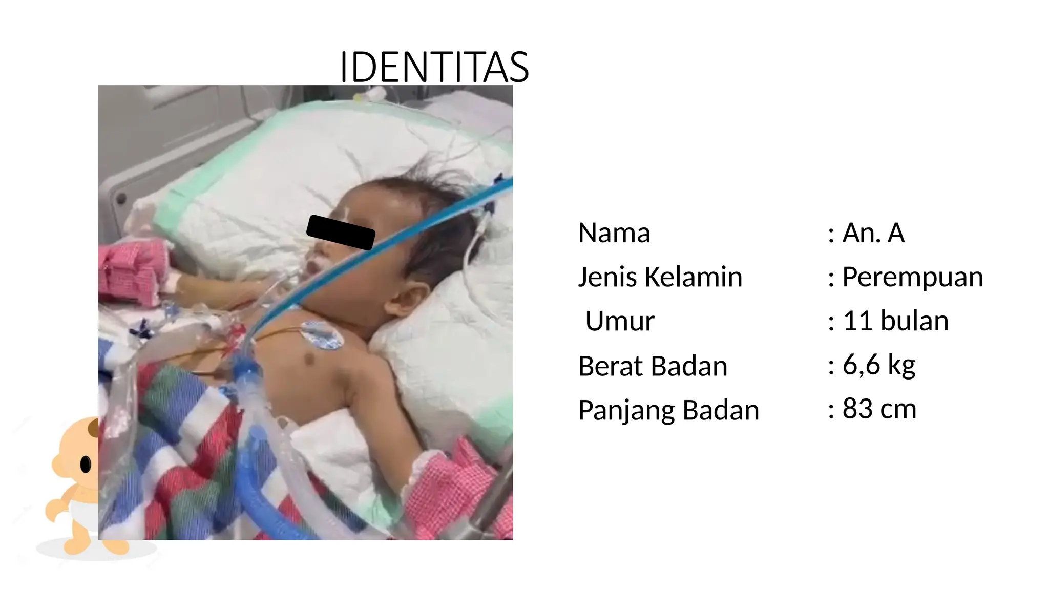 kondisi ketika isi toraks menonjol keluar dari batas anatomi normalnya ...