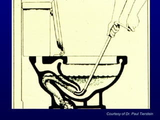 Repairing Coronary Arteries, pumpsandpipesmdhc | PPT
