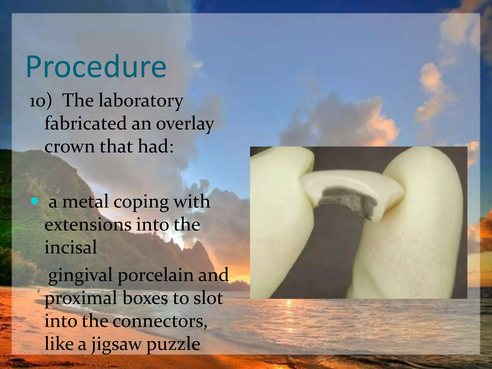 Repairing fractured pfm | PPTX