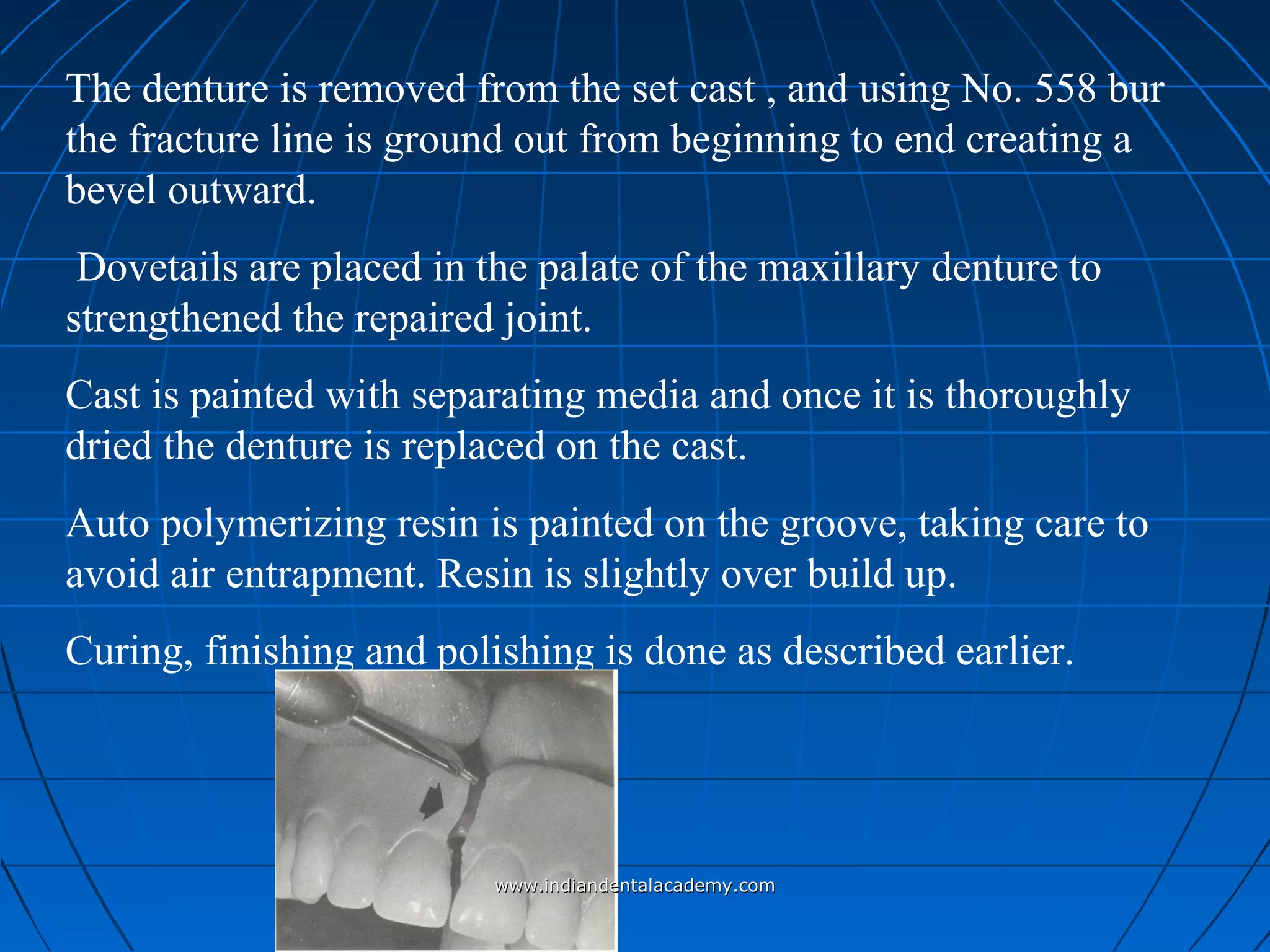 Repair of complete dentures/ Labial orthodontics | PPT